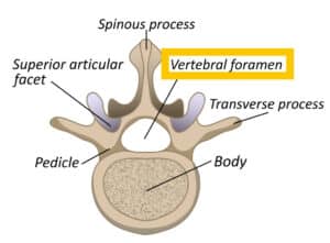 Navigating the Canals of the Spine: Central Canal and Neural Foramen ...